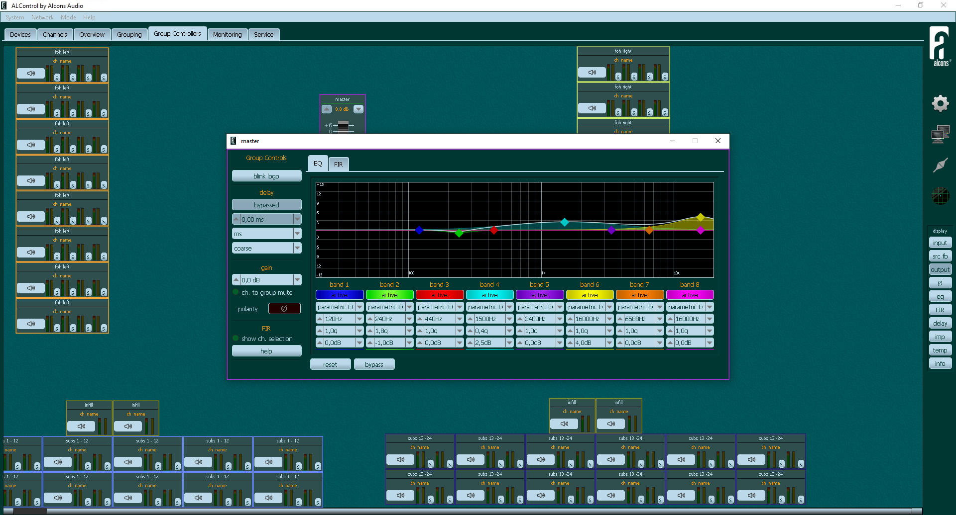 Remote Control - Alcons Audio